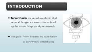 Tarsorrhaphy.pptx