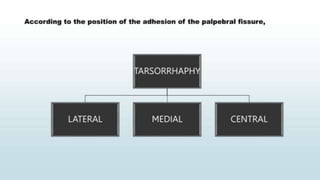 Tarsorrhaphy clinical features and management | PPTX