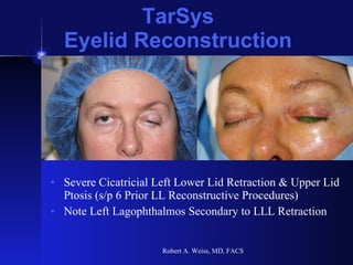 TarSys Slideshow - Dr. Robert A. Weiss | PPT