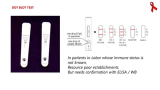 Laboratory diagnosis of HIV infection. | PPTX