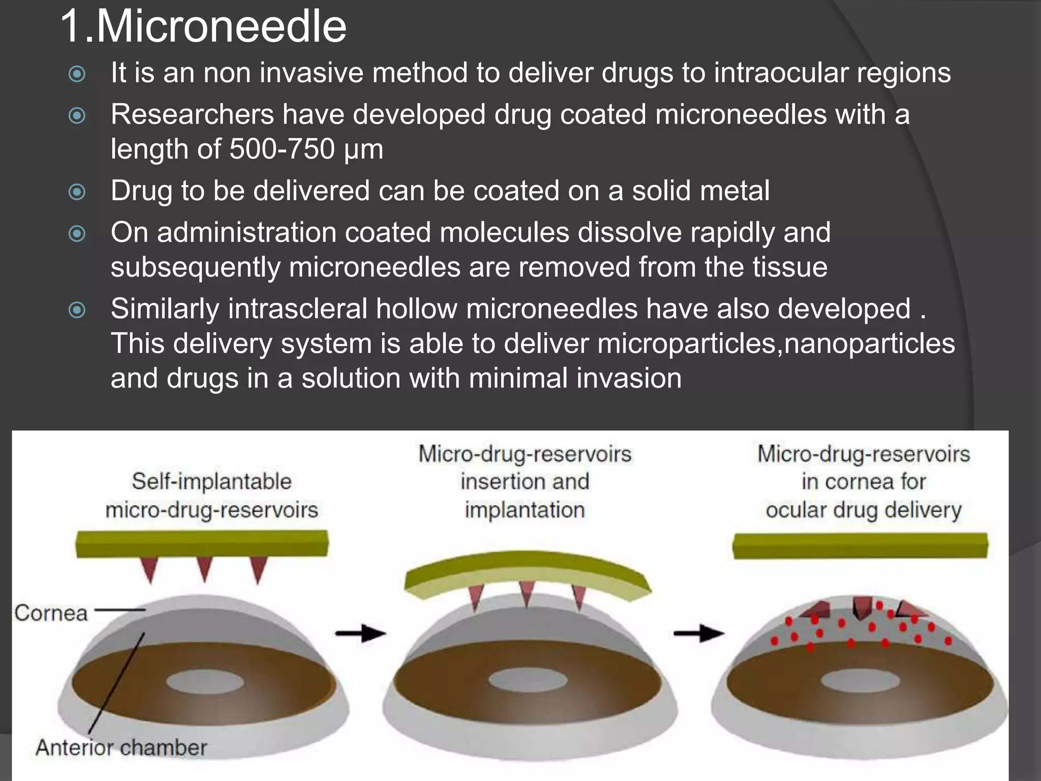 ocular barriers and methods to overcome barriers | PPTX