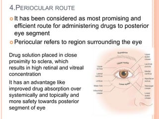 ocular barriers and methods to overcome barriers | PPTX