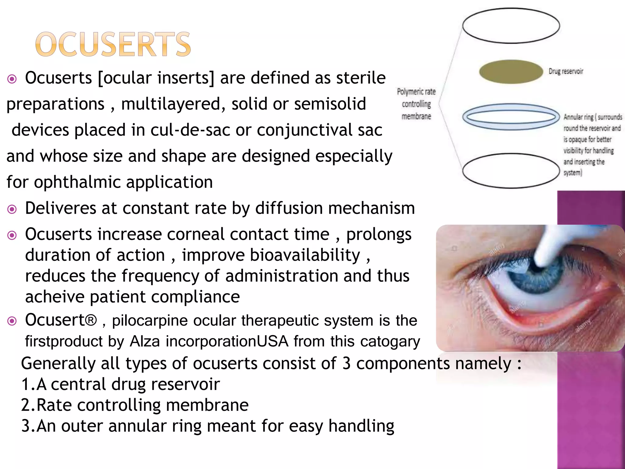 ocuserts [ocular inserts] | PPTX