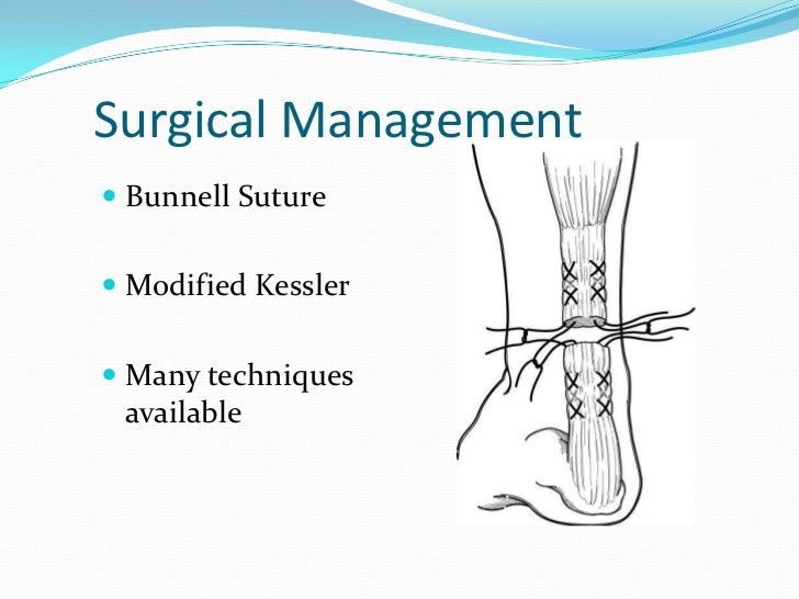 Management of TendoAchillis rupture
