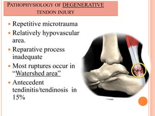 Tendoachilles rupture and its management | PPTX