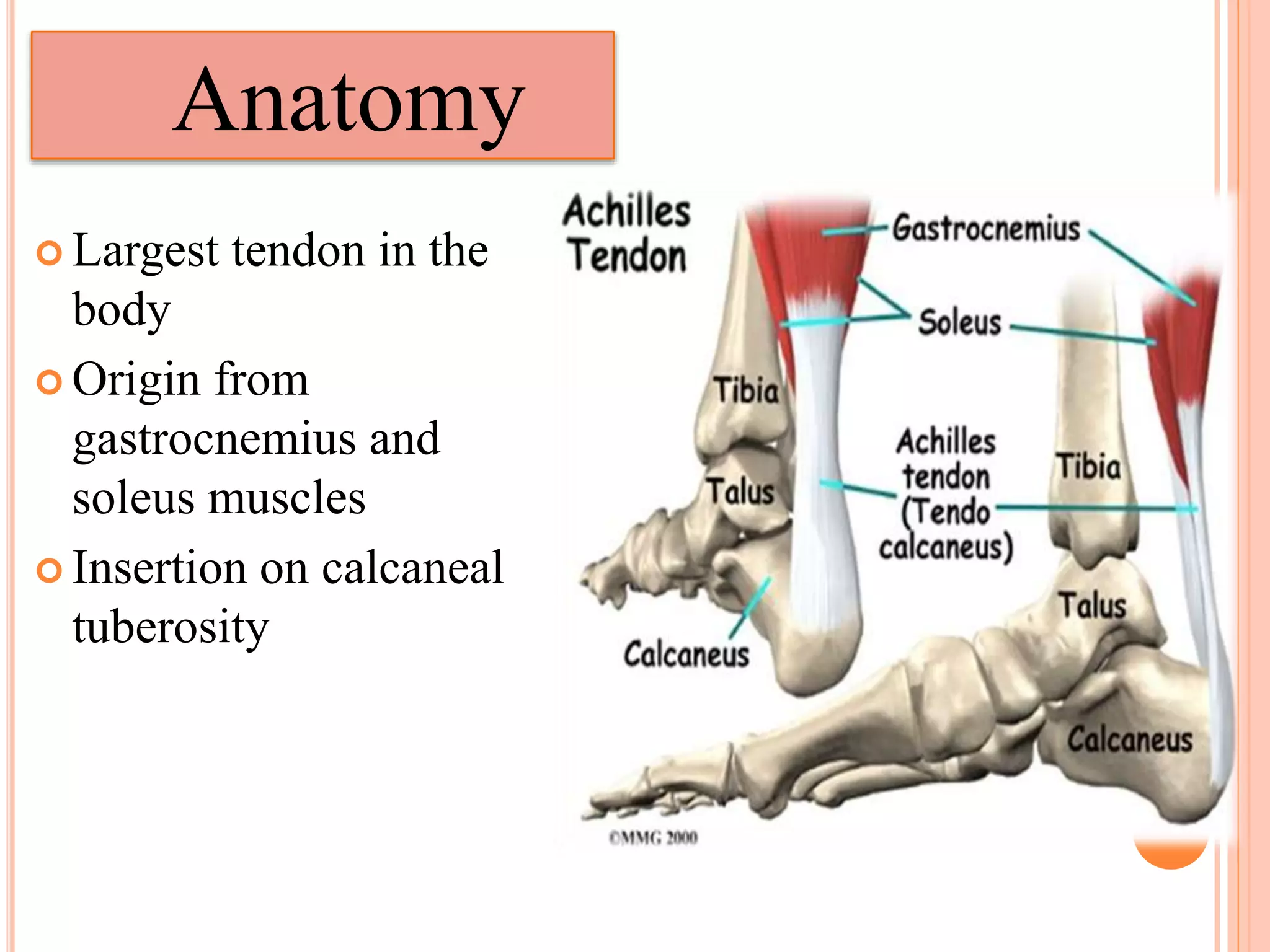 TA Rupture - DR Chandramani Roy | PPT