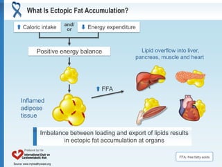 Ectopic Fat: An Important Feature of Intra-Abdominal Obesity in Type 2 ...