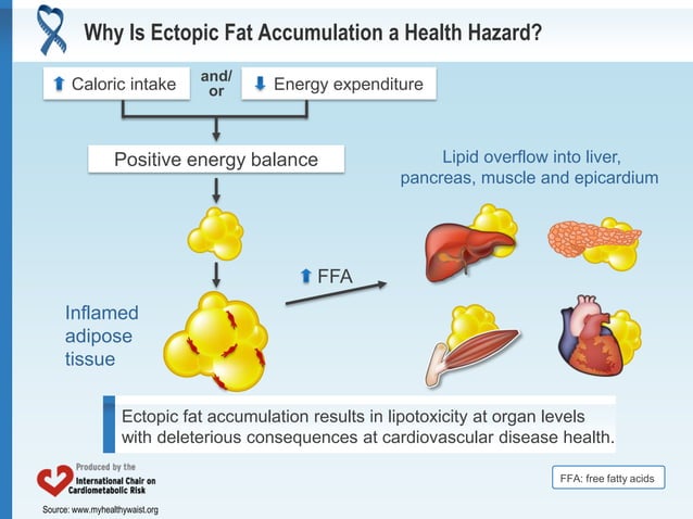 Ectopic Fat: An Important Feature of Intra-Abdominal Obesity in Type 2 ...