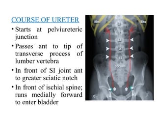 IVU radiology and imaging urogenital contrast | PPTX