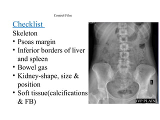 IVU radiology and imaging urogenital contrast | PPTX