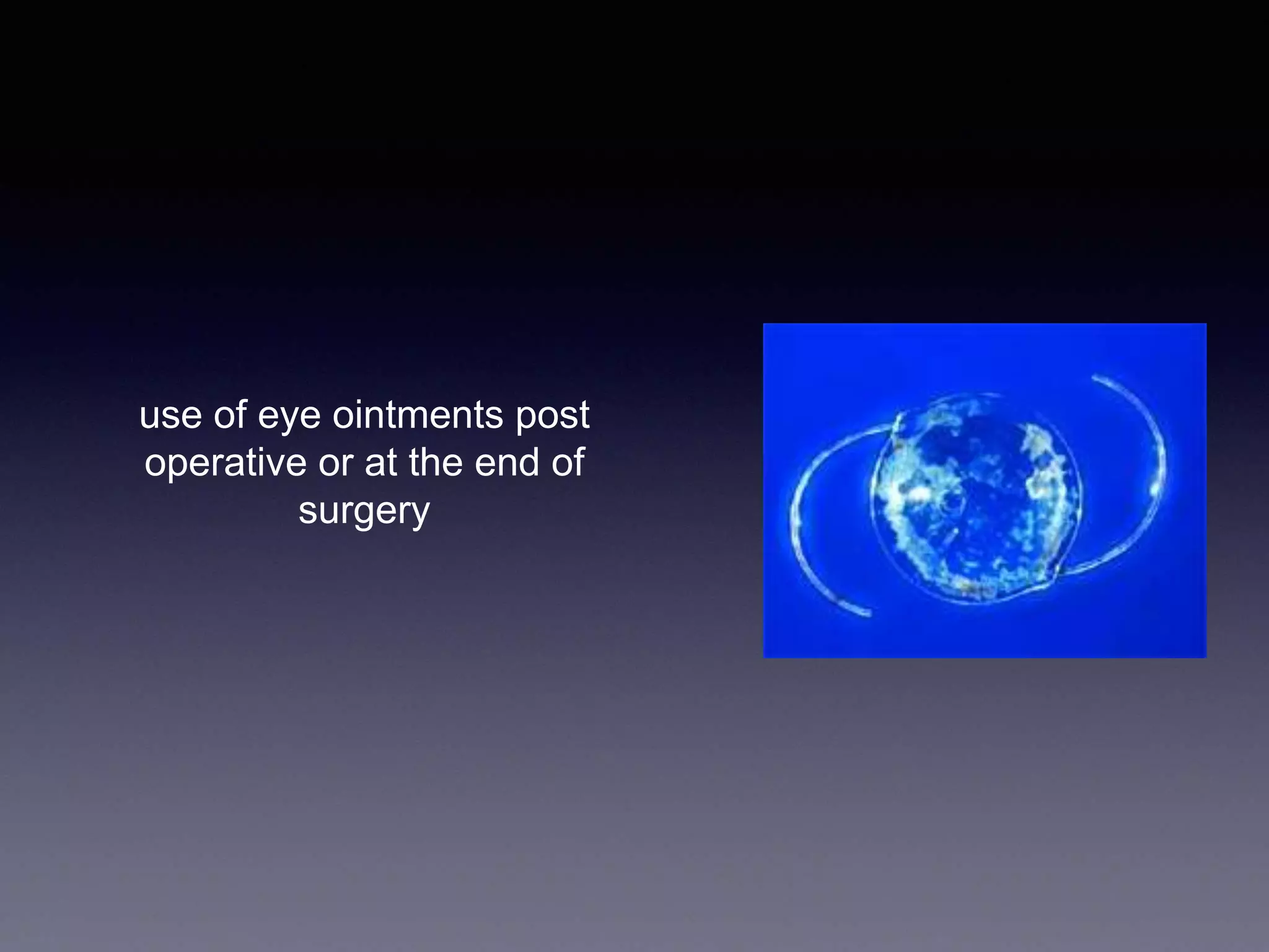 Causes of Toxic Anterior Segment Syndrome | PPTX | Eye and Vision ...