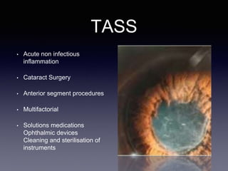 Causes of Toxic Anterior Segment Syndrome | PPTX | Eye and Vision ...