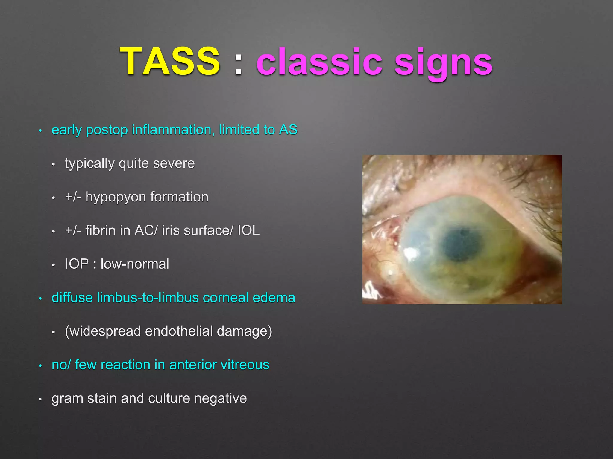 TASS vs Endophthalmitis | PPTX