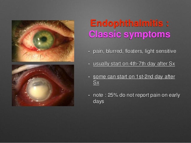 TASS vs Endophthalmitis