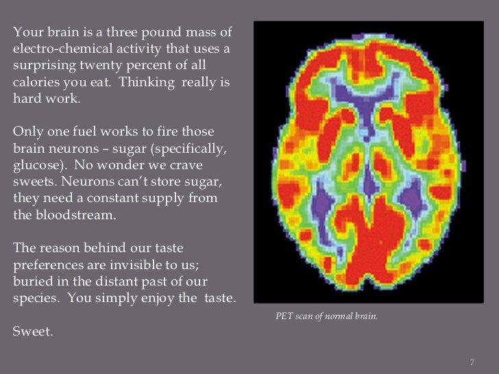 Taste: Your Brain on Food