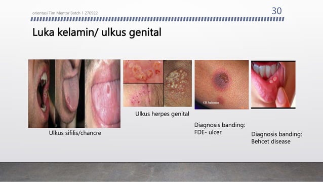TATALAKSANA IMS TERBARU tahun 2022_final.pptx