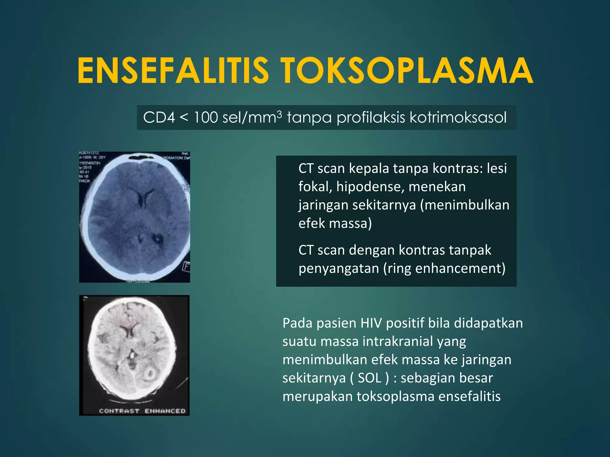Tatalaksana Infeksi Oportunistik | PPTX
