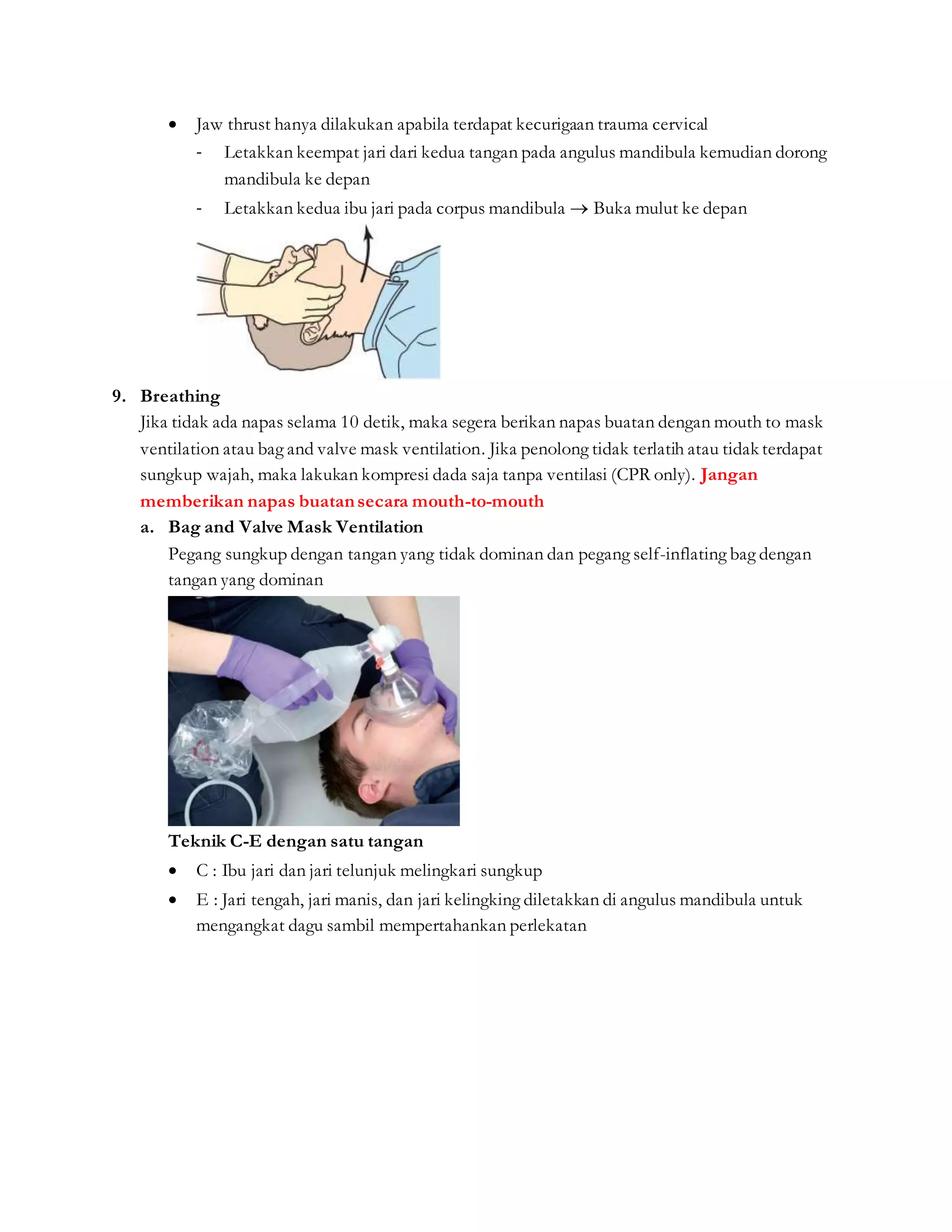Tata Laksana Jalan Napas | DOCX