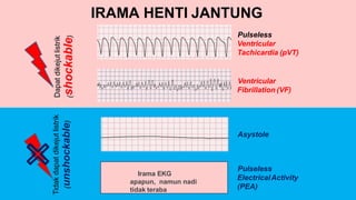 tatalaksana kardio 2021.pptx