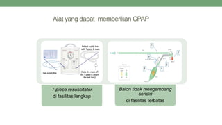 tatalaksana kegawatdaruratan neonatal.pdf