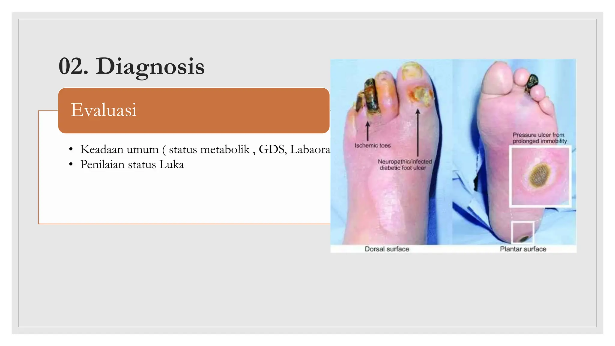 TATALAKSANA luka diabetes pembedahan.pptx