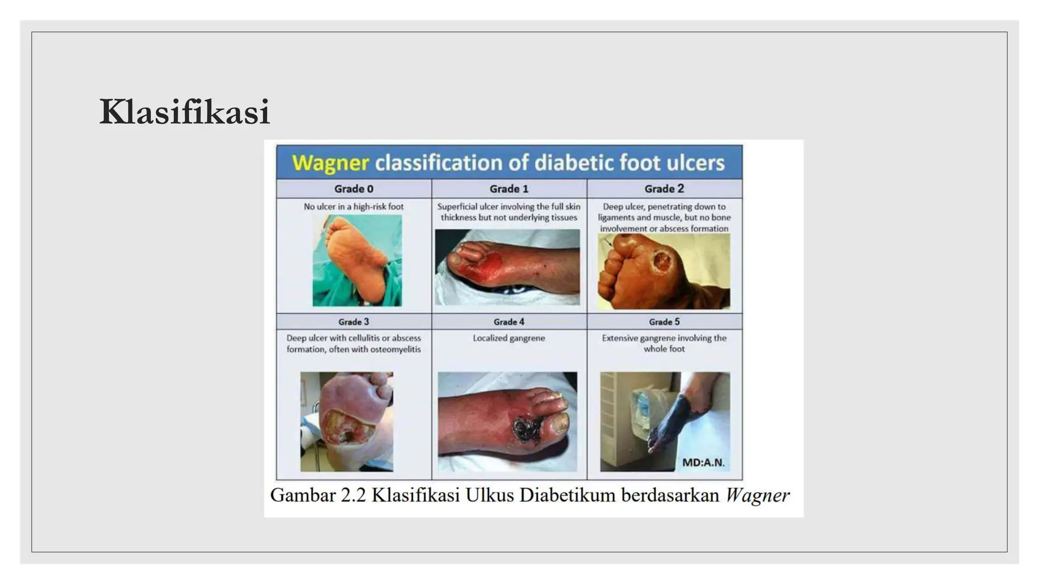 TATALAKSANA luka diabetes pembedahan.pptx