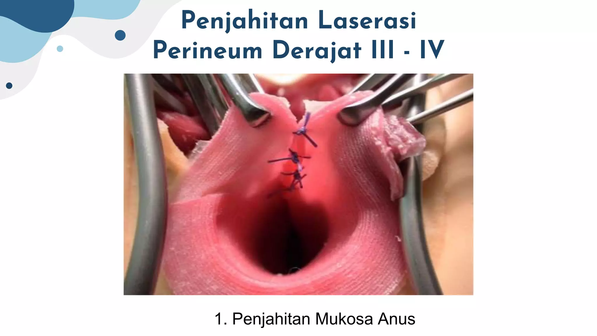 Tatalaksana OASIS.pptx