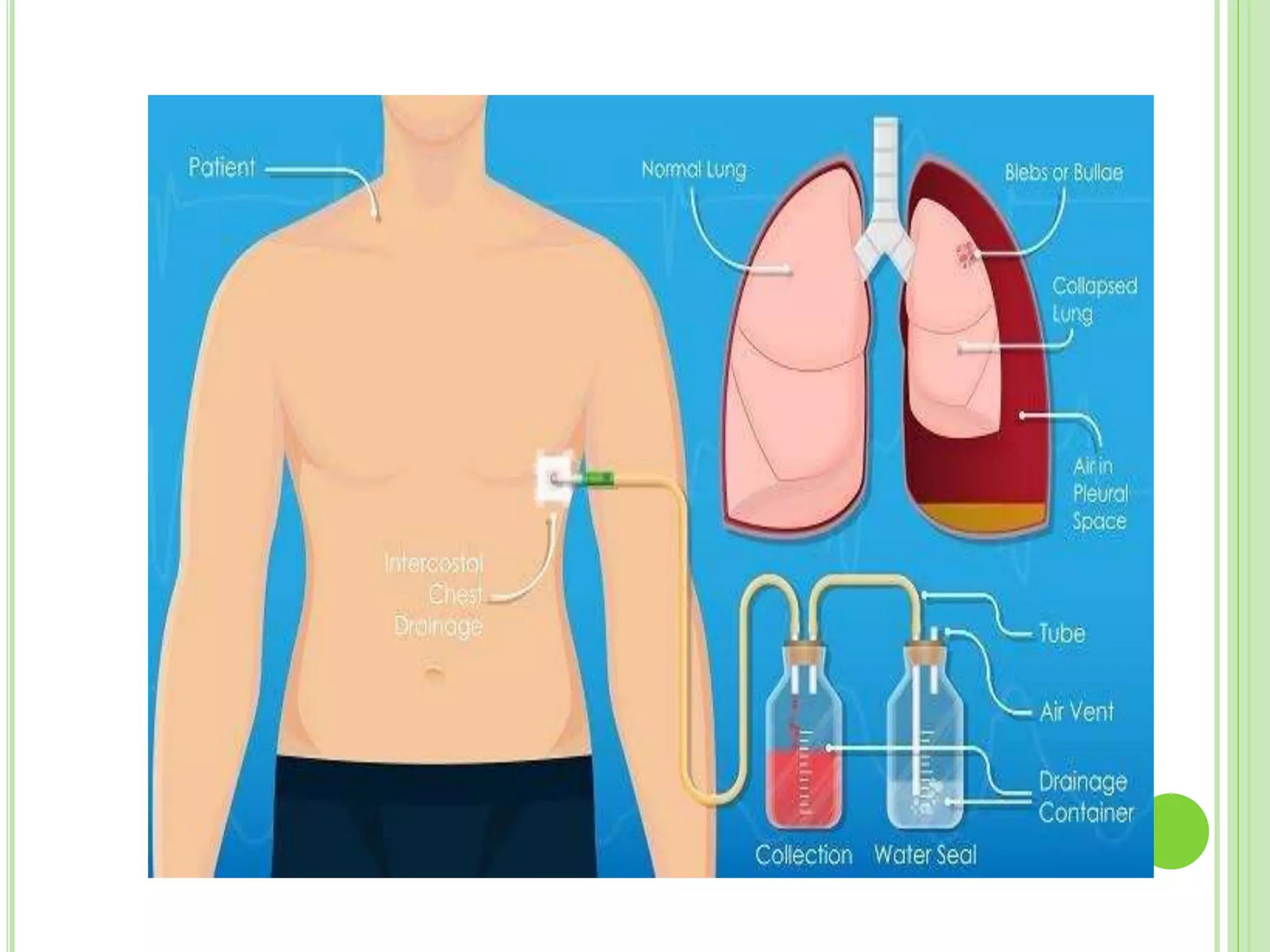 TATALAKSANA PASIEN DENGAN PEMASANGAN WSD_ANDRIANI.pptx
