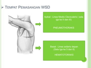 TATALAKSANA PASIEN DENGAN PEMASANGAN WSD_ANDRIANI.pptx