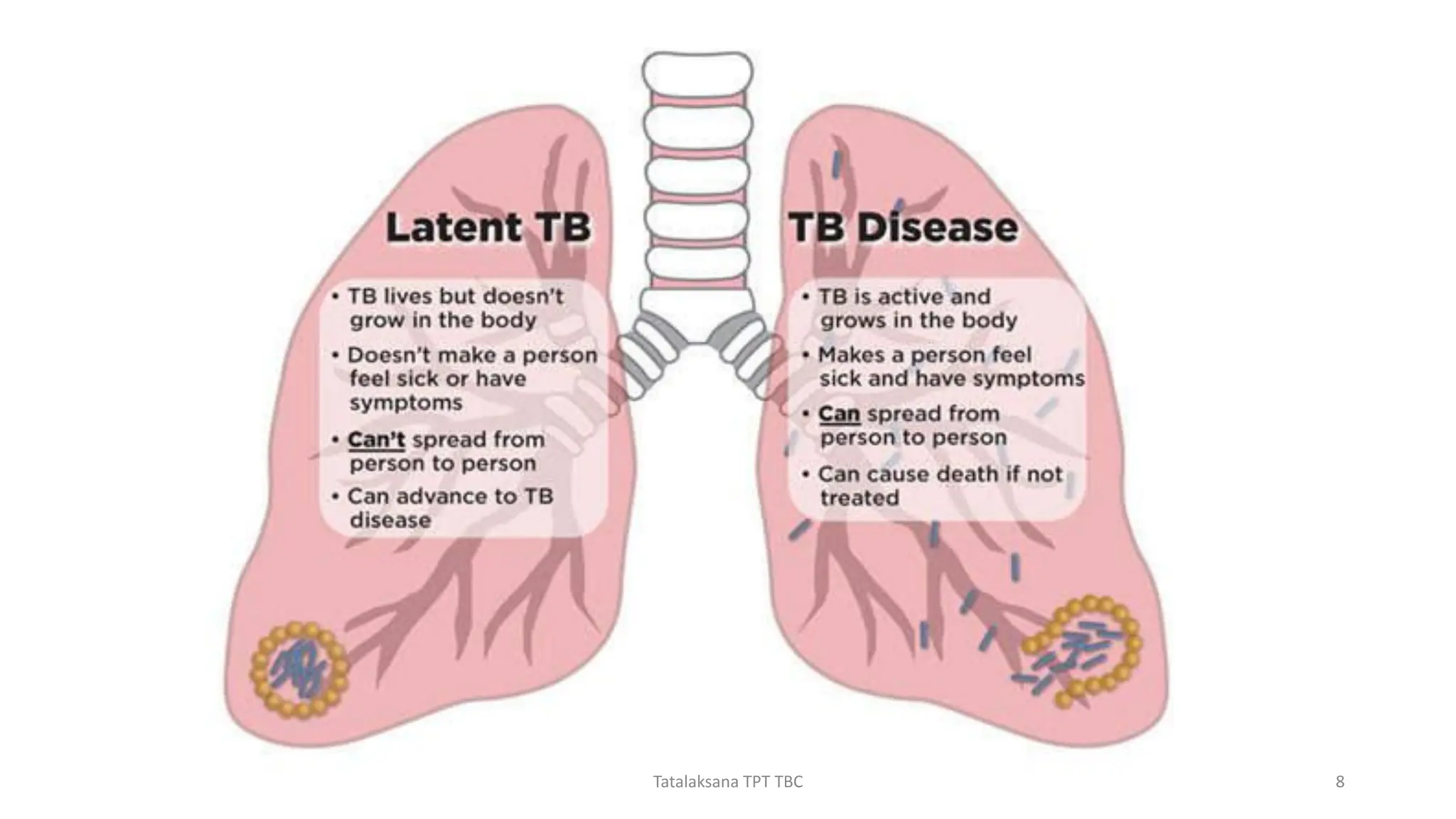 Tatalaksana Pemberian Terapi Pencegahan TPT TB. Pdf | PDF