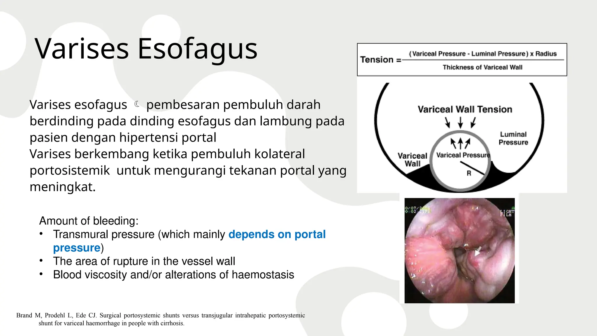 Tatalaksana perdarahan saluran cerna variseal.pptx