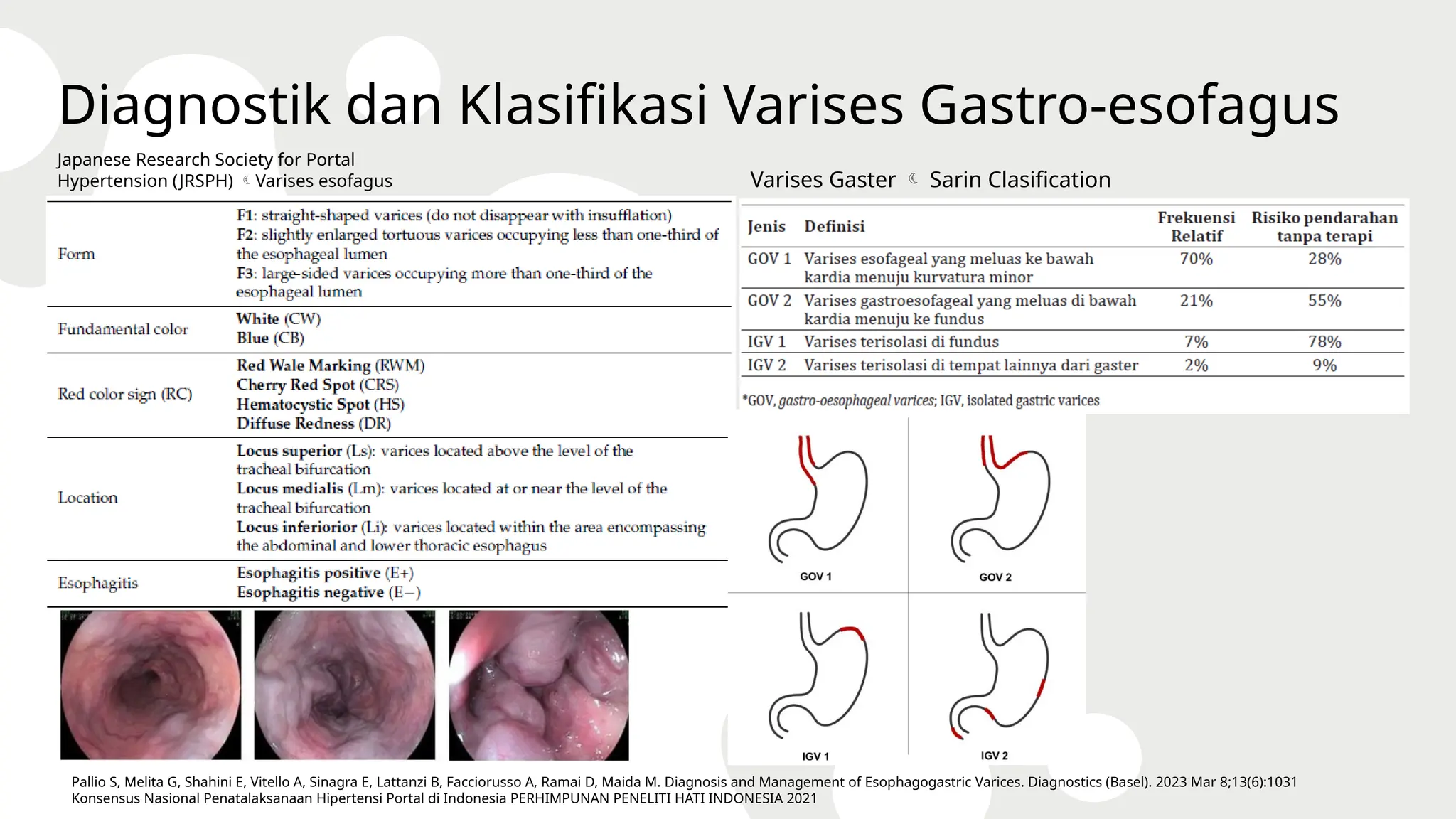 Tatalaksana perdarahan saluran cerna variseal.pptx