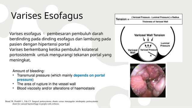 Tatalaksana perdarahan saluran cerna variseal.pptx