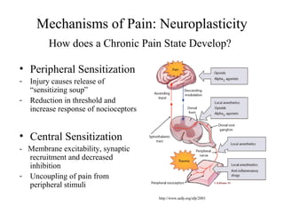 Current Concepts and Strategies in Pain Management | PPT | Physical ...