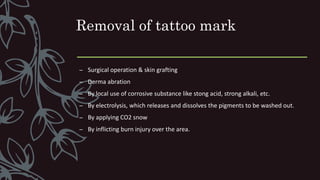 Medico-legal Importance of Tattoo Marks in Forensic victim ...
