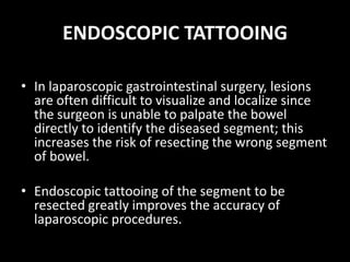 Tattoo presentation | PPTX