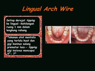 Management Crowded Anterior On Children | PPTX