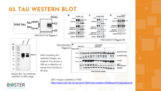 Learn Tau in 3 minutes | Microtubule-associated protein tau (MAPT) | PPTX