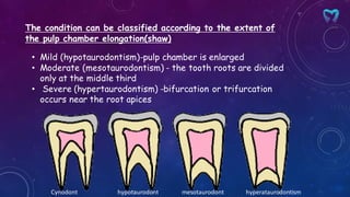 TAURODONTISM.pdf