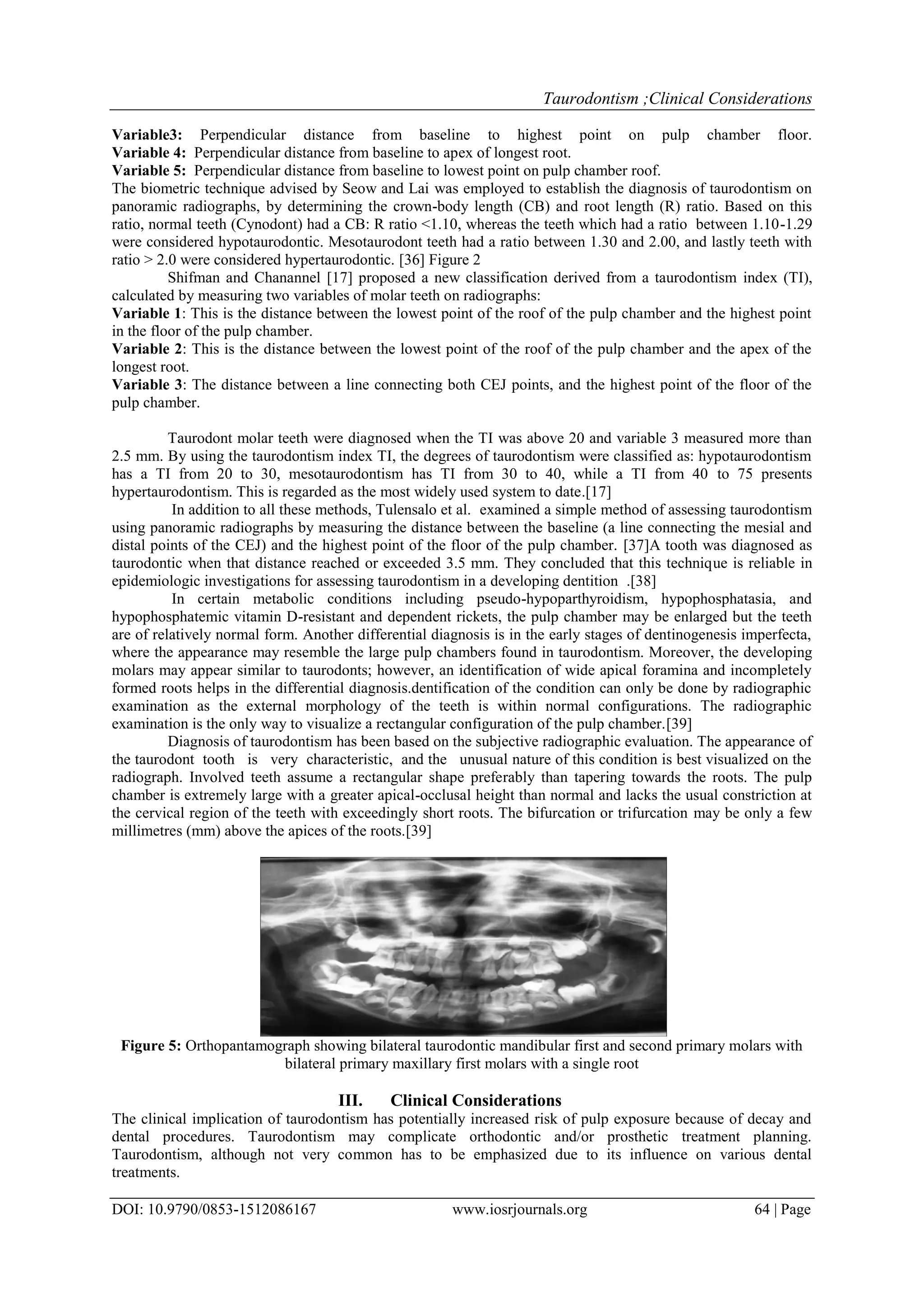 Taurodontism; clinical considerations | PDF
