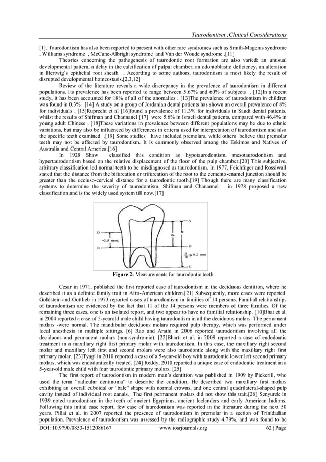 Taurodontism; clinical considerations | PDF