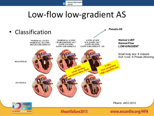 Unraveling low-flow , low-gradient aotic stenosis fabian nestispach H…