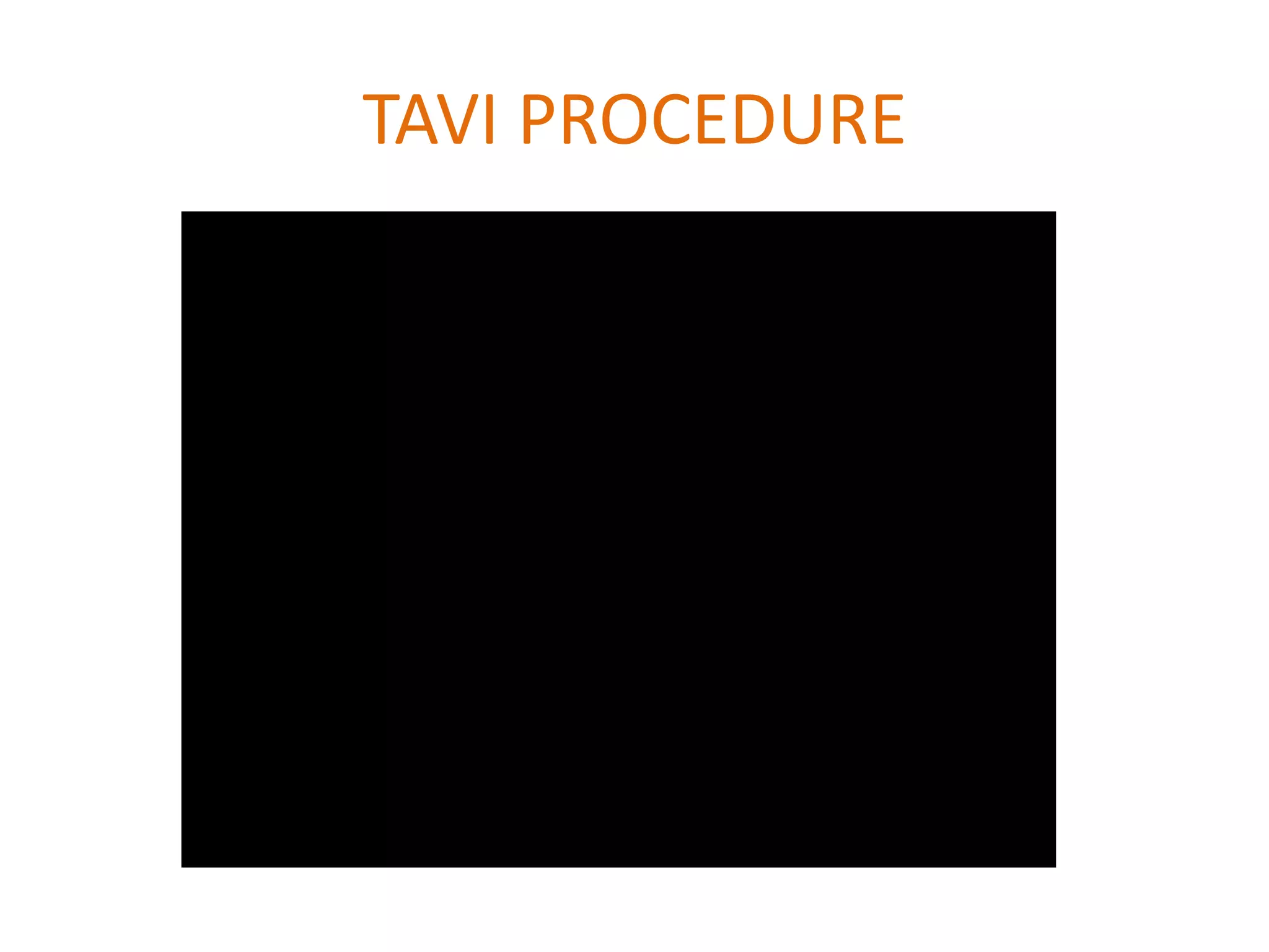 Tavi,Transcatheter Aortic Valve Replacement, TAVI,TAVR, | PPTX