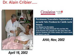 Tavi,Transcatheter Aortic Valve Replacement, TAVI,TAVR, | PPTX