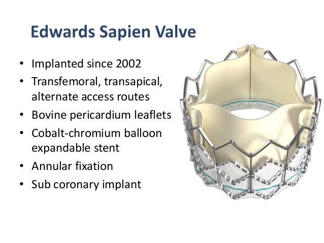 Tavi,Transcatheter Aortic Valve Replacement, TAVI,TAVR,