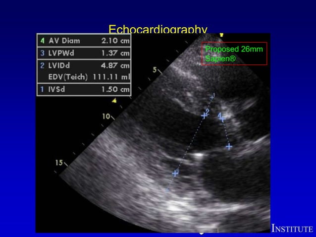 TAVI procedure review with cases | PPTX | Heart and Cardiovascular ...
