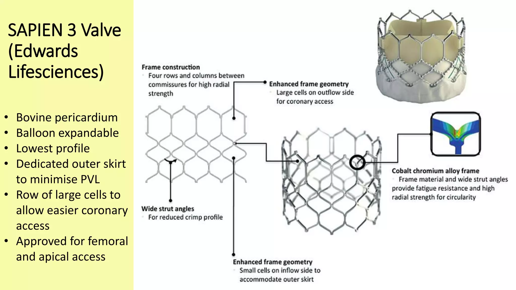 TAVI - Transcatheter Aortic Valve Implantation | PPTX