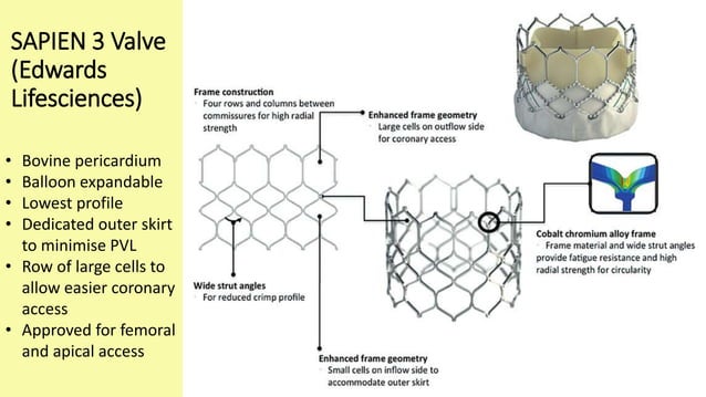 TAVI - Transcatheter Aortic Valve Implantation | PPTX | Heart and ...
