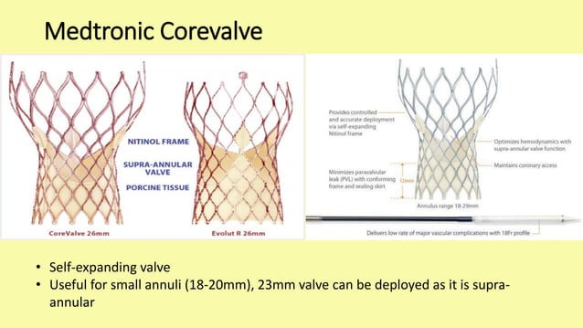 TAVI - Transcatheter Aortic Valve Implantation | PPTX | Heart and ...