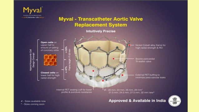 TAVI - Transcatheter Aortic Valve Implantation | PPTX | Heart and ...